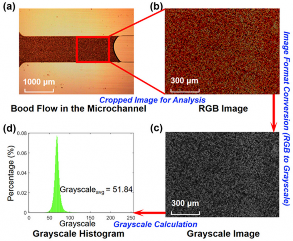 Microfluidic-Based Novel Optical Quantification of Red Blood Cell ...